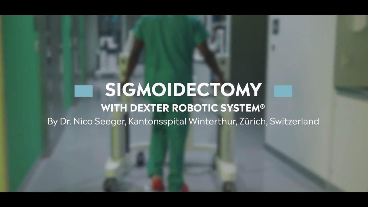 Sigmoidectomy with DEXTER® Robotic System - YouTube
