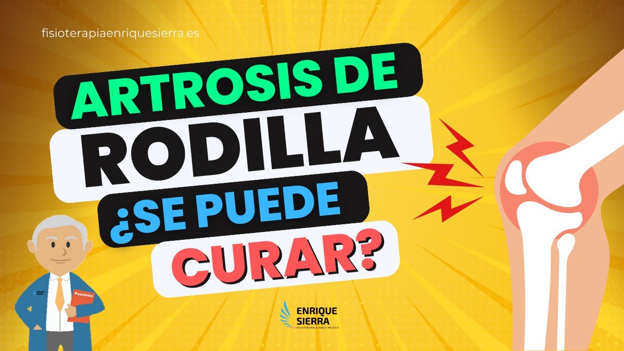 ARTROSIS DE RODILLA QUÉ ES, SÍNTOMAS, CAUSAS, TRATAMIENTO Y EJERCICIOS ...