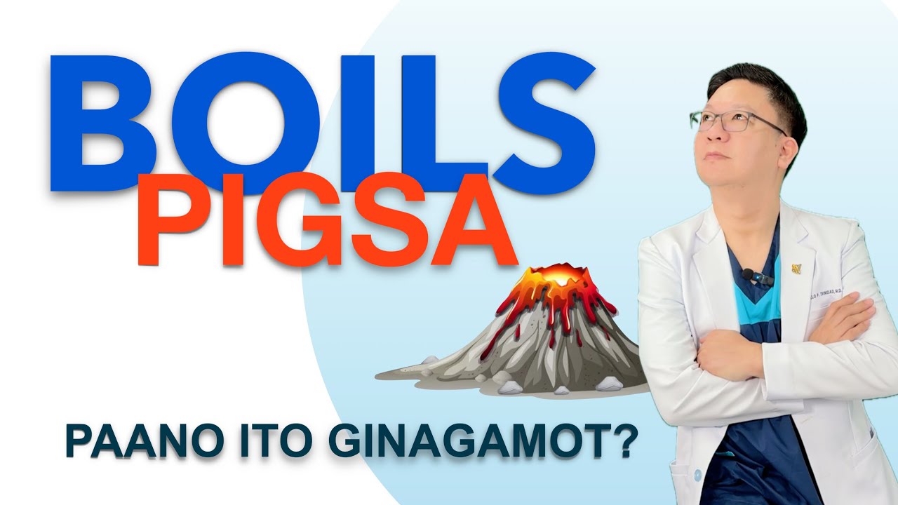 PAANO GAMUTIN ANG PIGSA (BOIL)? - YouTube