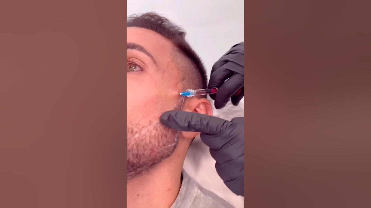 REAL MEIWNG💀3 EXCLUSIVE EXERCISES!#mewing #staynatural #naturalmakeup #nature #shelove - YouTube