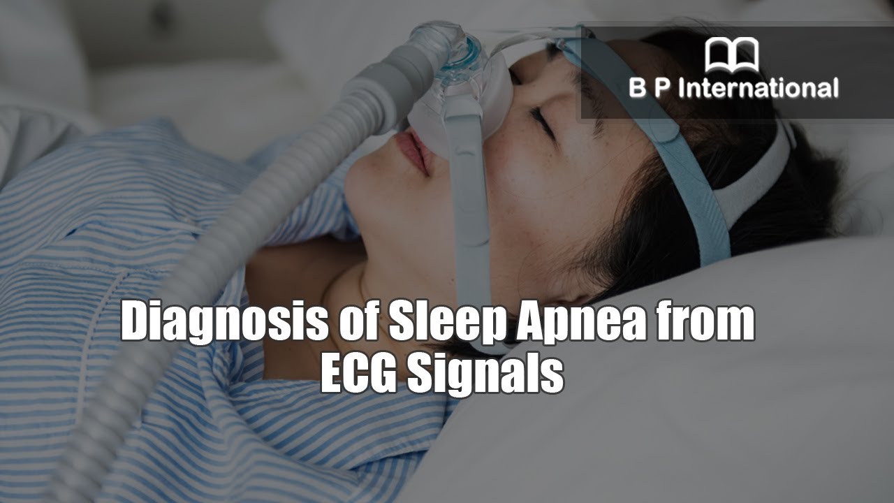 Diagnosis of Sleep Apnea from ECG Signals - YouTube