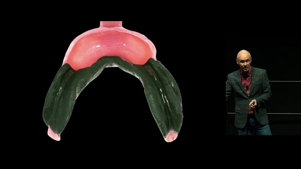 Finlay Sutton - Removable partial dentures - YouTube