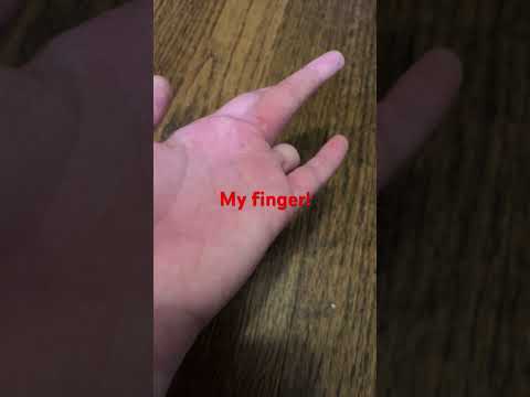 My finger got cut off - YouTube
