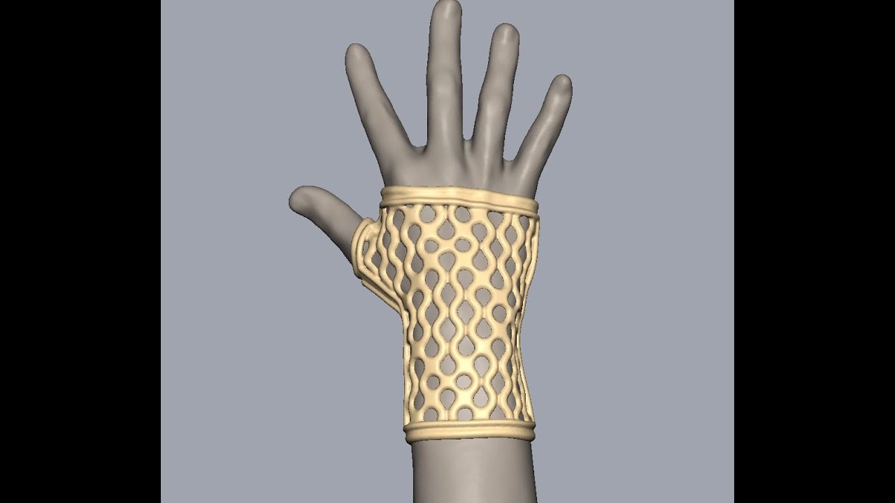 Custom Wrist Brace Design from 3d Scan Data using Geomagic FreeForm ...