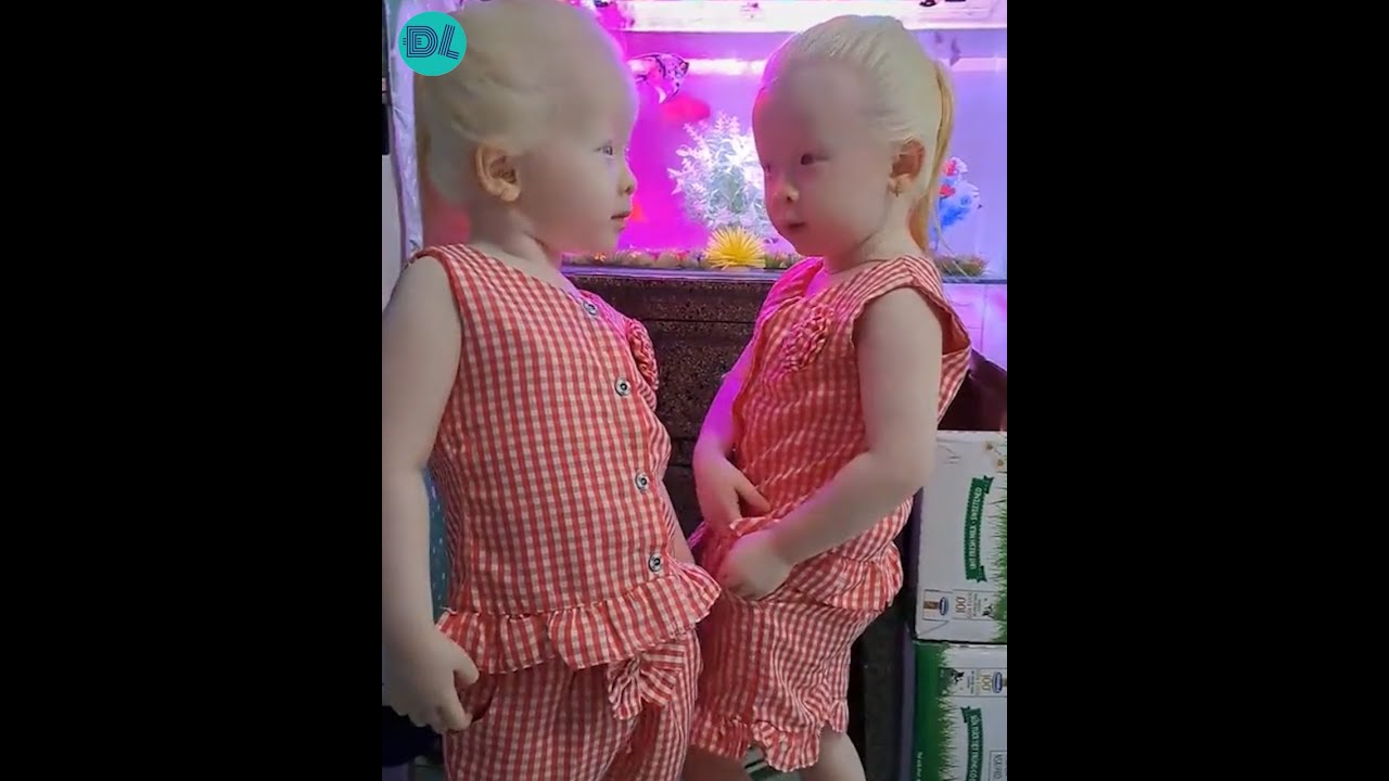 Cặp song sinh thiên thần tính cách khác nhau một trời một vực - ĐỘC LẠ ...