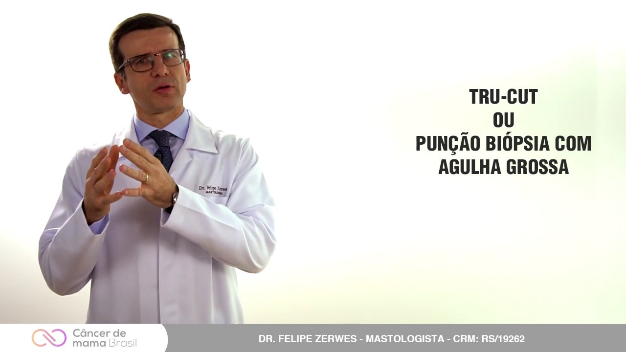 BIÓPSIA DE MAMA - CORE BIOPSY OU TROCARTE. - YouTube