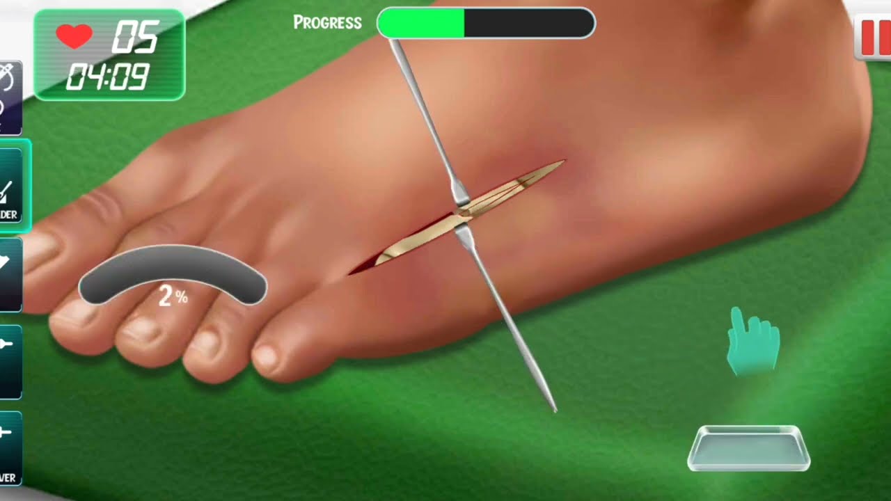 Orthopaedic || The caring souls|| doctors game || kids doctor gameplay ...