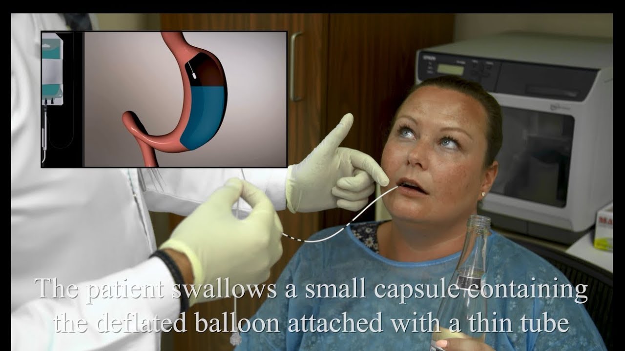 What is Allurion Program? learn more with Dr. Hady Jerdak - YouTube