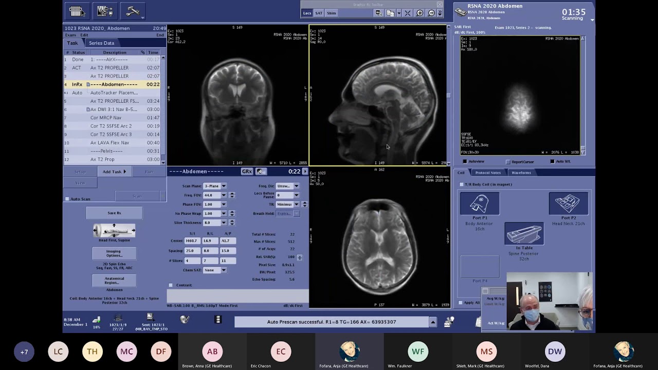 SIGNA™ Voyager Live Scanning Body Imaging Demo Using AIR™ Coils - YouTube