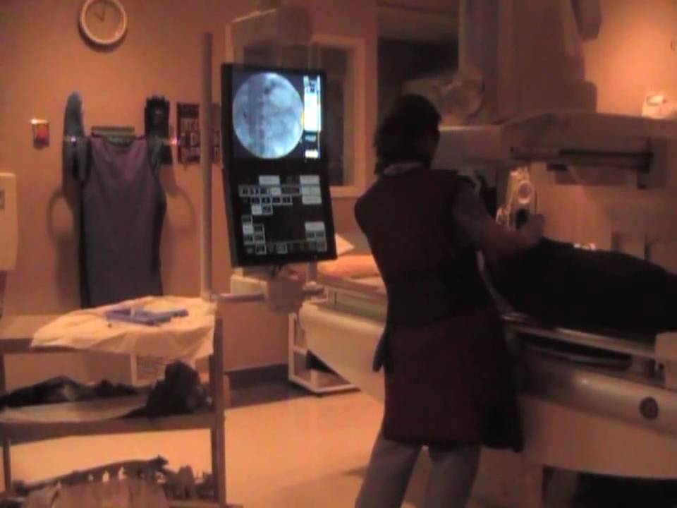 Realize Band Fluoroscopy Fill with Dr. Qammar Rashid - YouTube