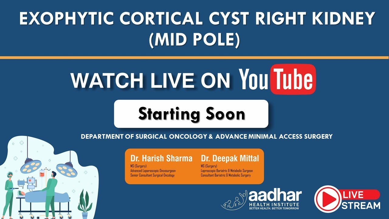 EXOPHYTIC CORTICAL CYST RIGHT KIDNEY (MID POLE) - YouTube