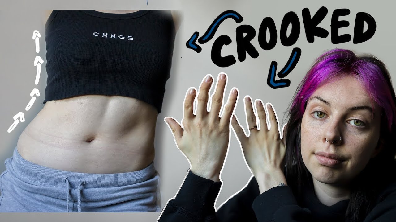 watch this if you feel insecure about yourself. (showing my biggest ...