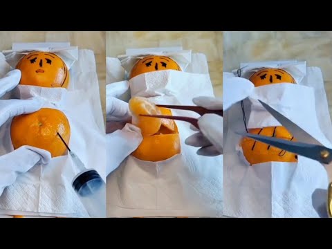 সিজার করা দেখুন #sijar #mini #grill - YouTube