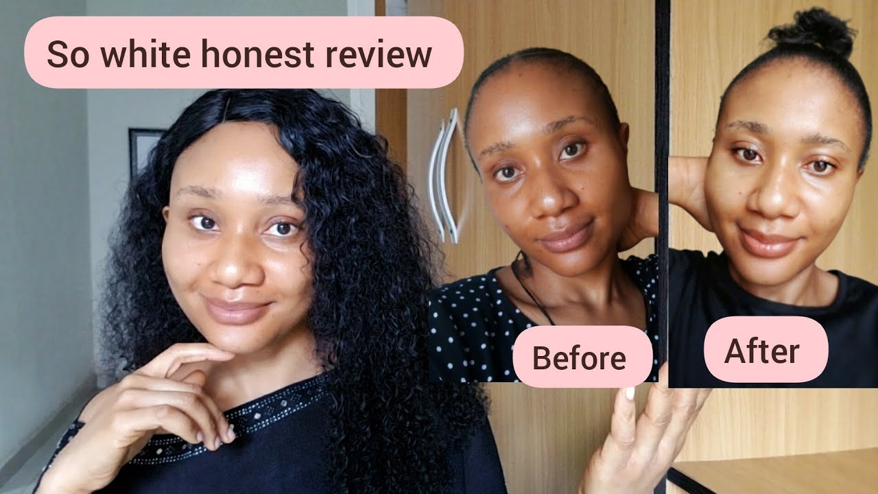 SO WHITE FACE SOLUTION HONEST REVIEW affordable face creams that works ...