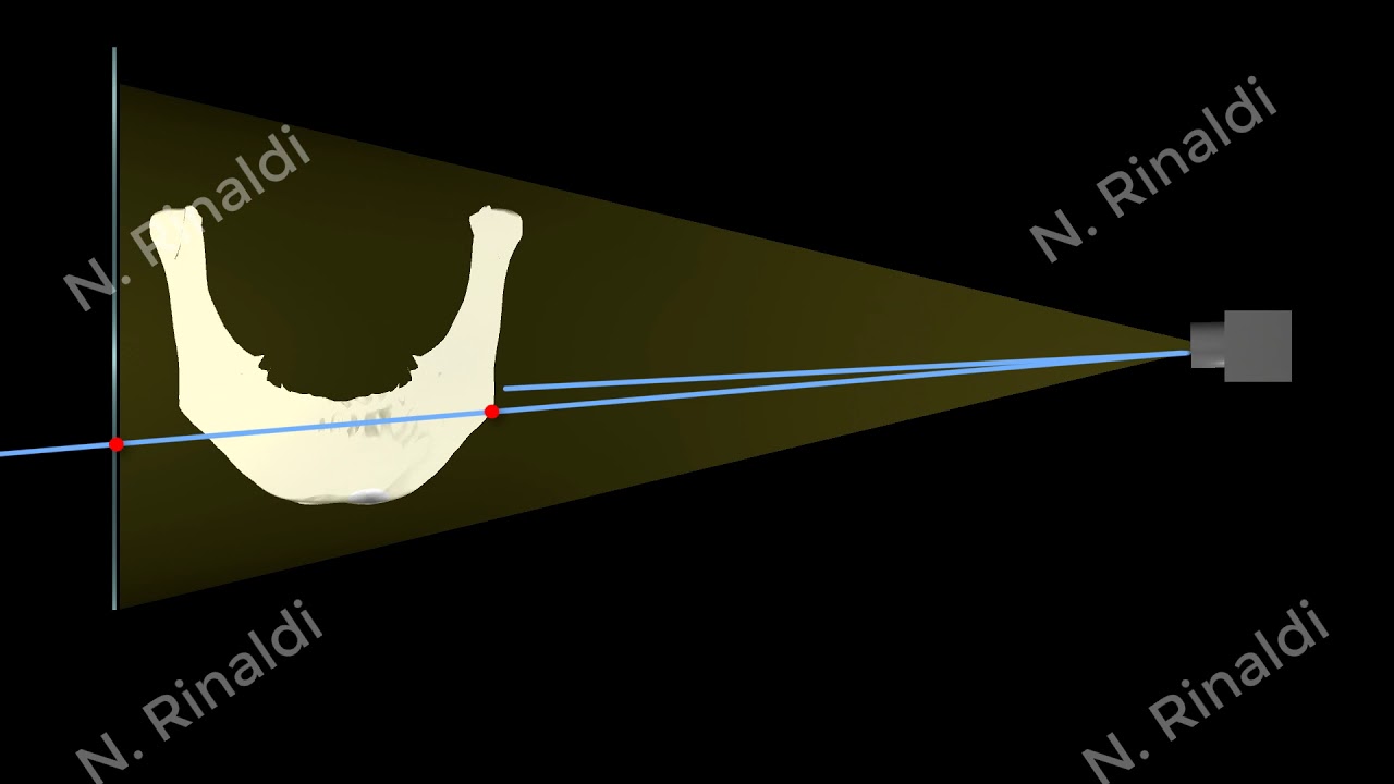 Latero-lateral teleradiography and asimmetry - YouTube