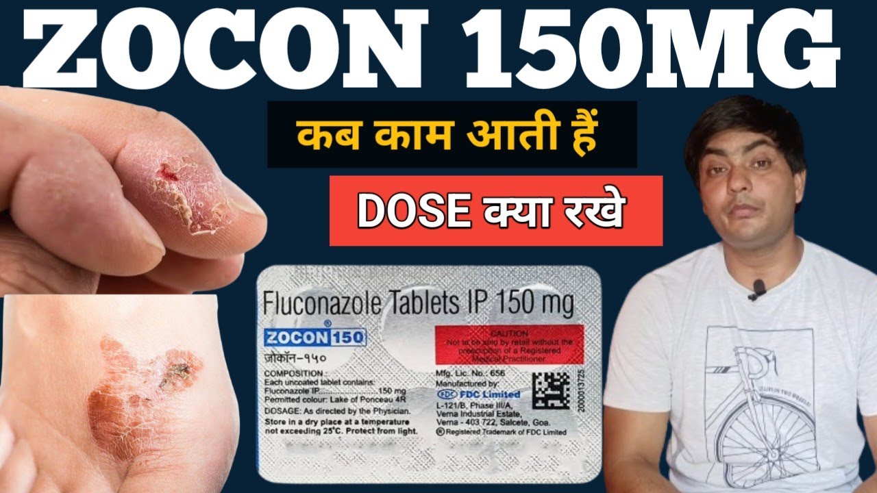 zocon 150 | zocon 150 is used for in hindi | zocon 150 tablet | zocon ...