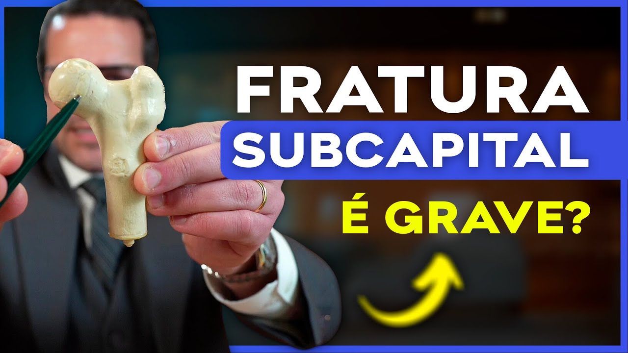 O que é fratura subcapital do fêmur? Tem como reverter? - YouTube