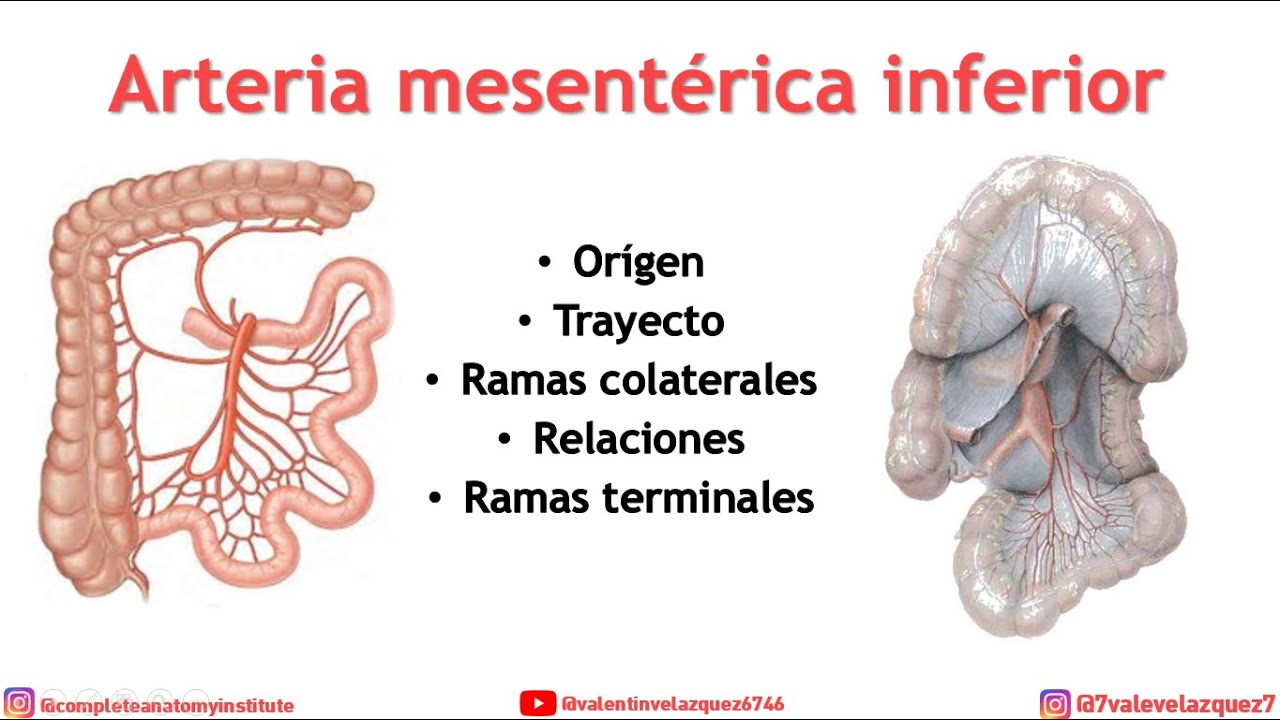 ARTERIA MESENTÉRICA INFERIOR (Orígen, trayecto, terminación, ramas ...