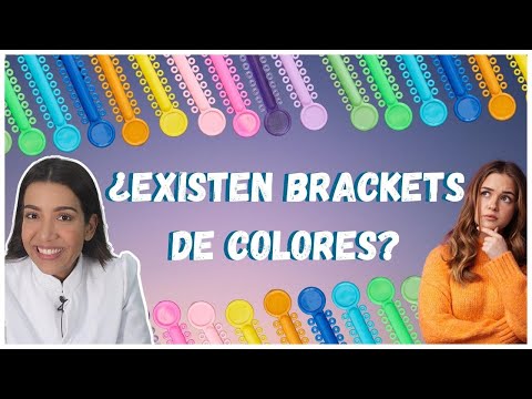 Brackets Con Ligas De Colores: La Información Para Una Sonrisa Radiante ...