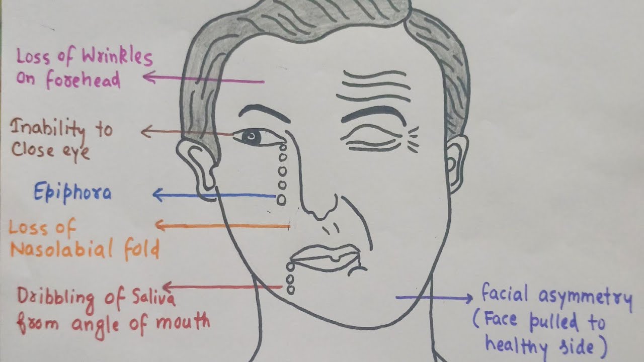 NERVE SUPPLY OF FACE ( Clinical Anatomy ) - YouTube
