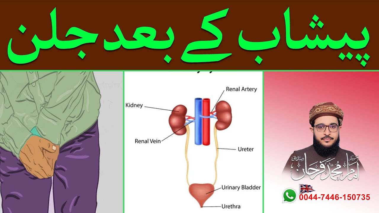 Peeshab Kay Bad Jalan | Urine Infection | Farhan Siddique - YouTube