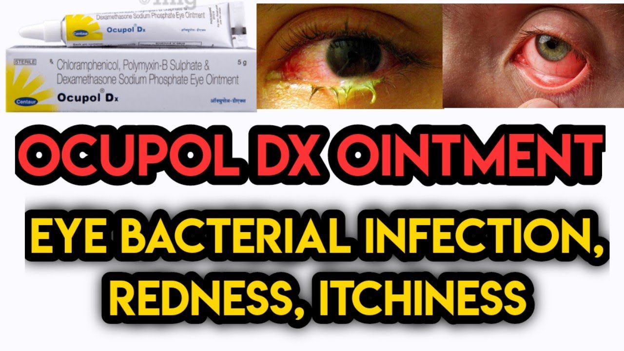 Ocupol Dx Eye Ointment Review In Hindi YouTube ocupol-dx-eye-ointment-review-in-hindi-youtube