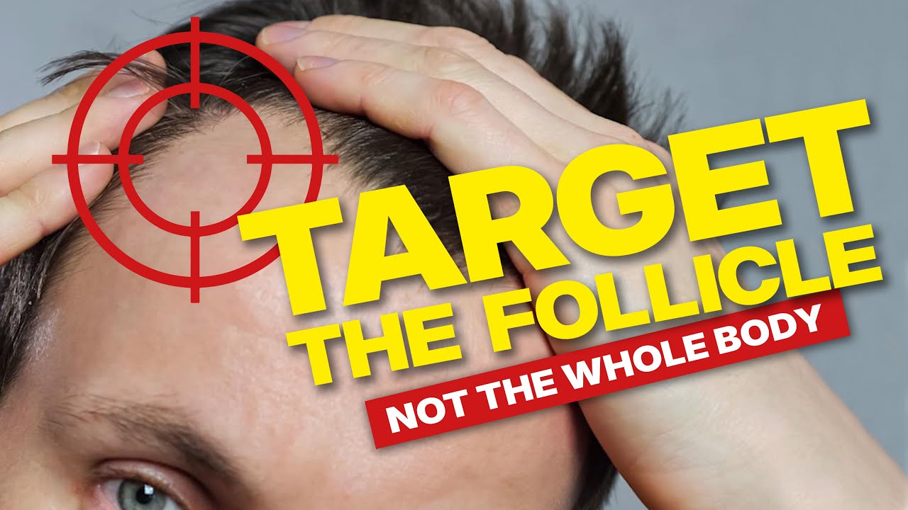 How to remove DHT from the scalp (and regrow hair) - YouTube