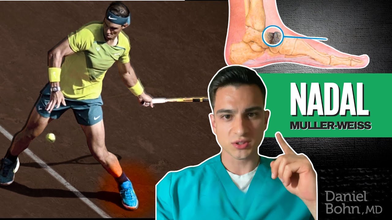 LESÃO INCURÁVEL DE RAFAEL NADAL - SÍNDROME DE MULLER-WEISS - OSSO NAVICULAR | Daniel Bohn - YouTube