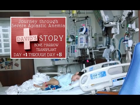 David's Story: Bone Marrow Transplant Day +1 through Day +5 - YouTube
