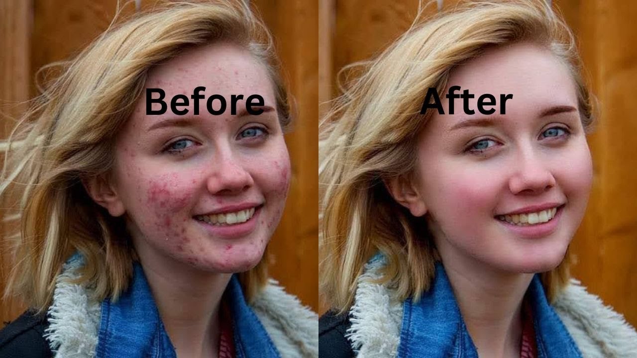 Photo Retouching technique |phtoshop retouching channel masking - YouTube