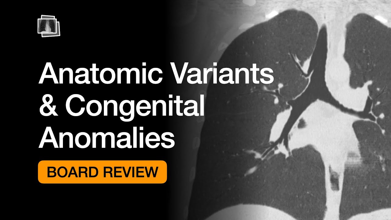 Anatomic Variants & Congenital Anomalies | Chest Radiology Board Review ...