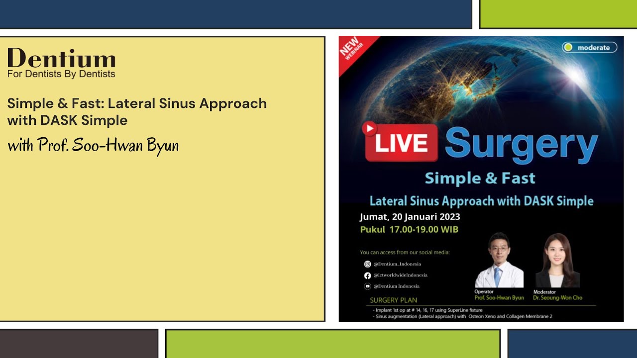 Live Surgery "Simple & Fast: Lateral Sinus Approach with DASK Simple" - YouTube
