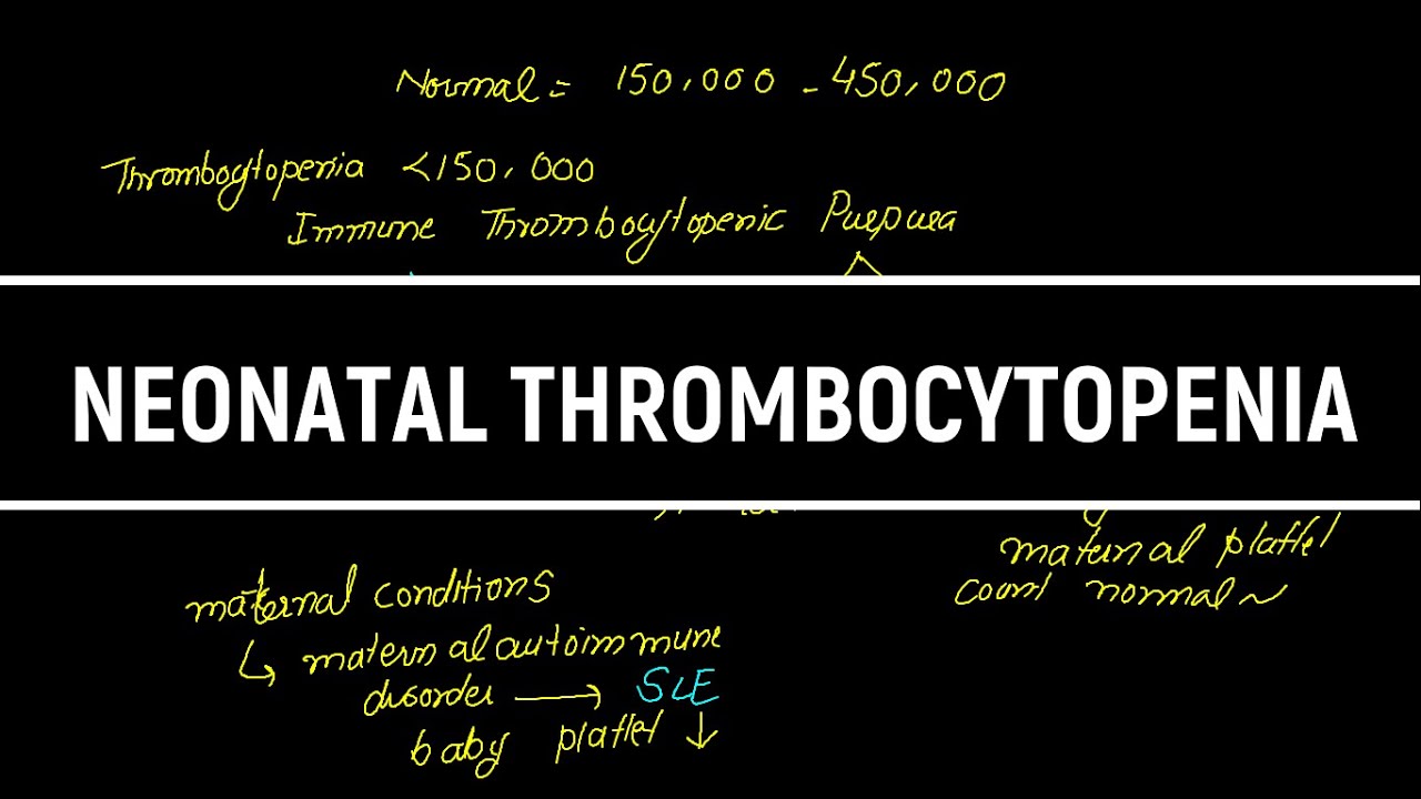 Neonatal Thrombocytopenia Alloimmune And Autoimmune Pathogenesis