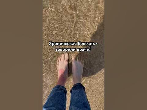 Всё в твоей голове! Излечить болезнь можно с помощью… - YouTube