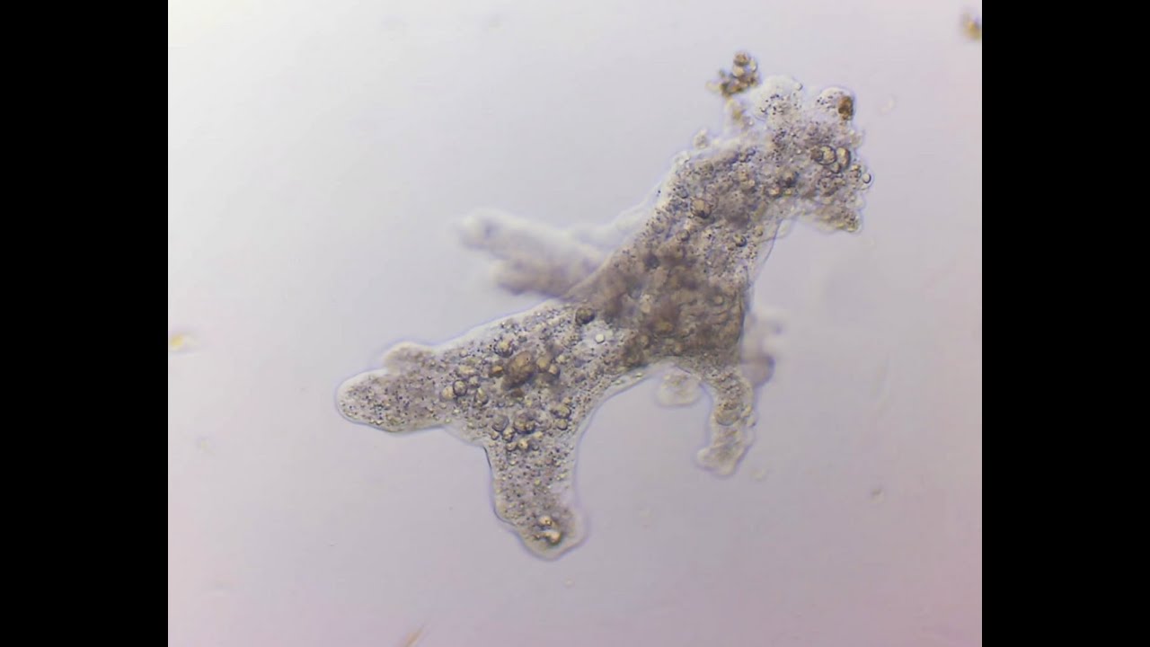 Amoeba proteus, found in the river Cam at Grantchester Meadows ...