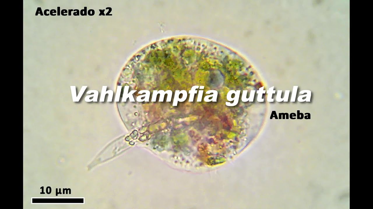 Vahlkampfia guttula (Ameba) infectada por el hongo Amoebophilus sp ...