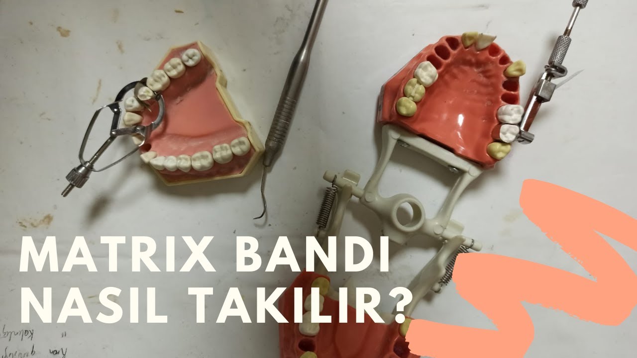Matrix Bandı Nasıl Takılır? Kama Nasıl Takılır? (Halka-Düz-Tofflemire ...
