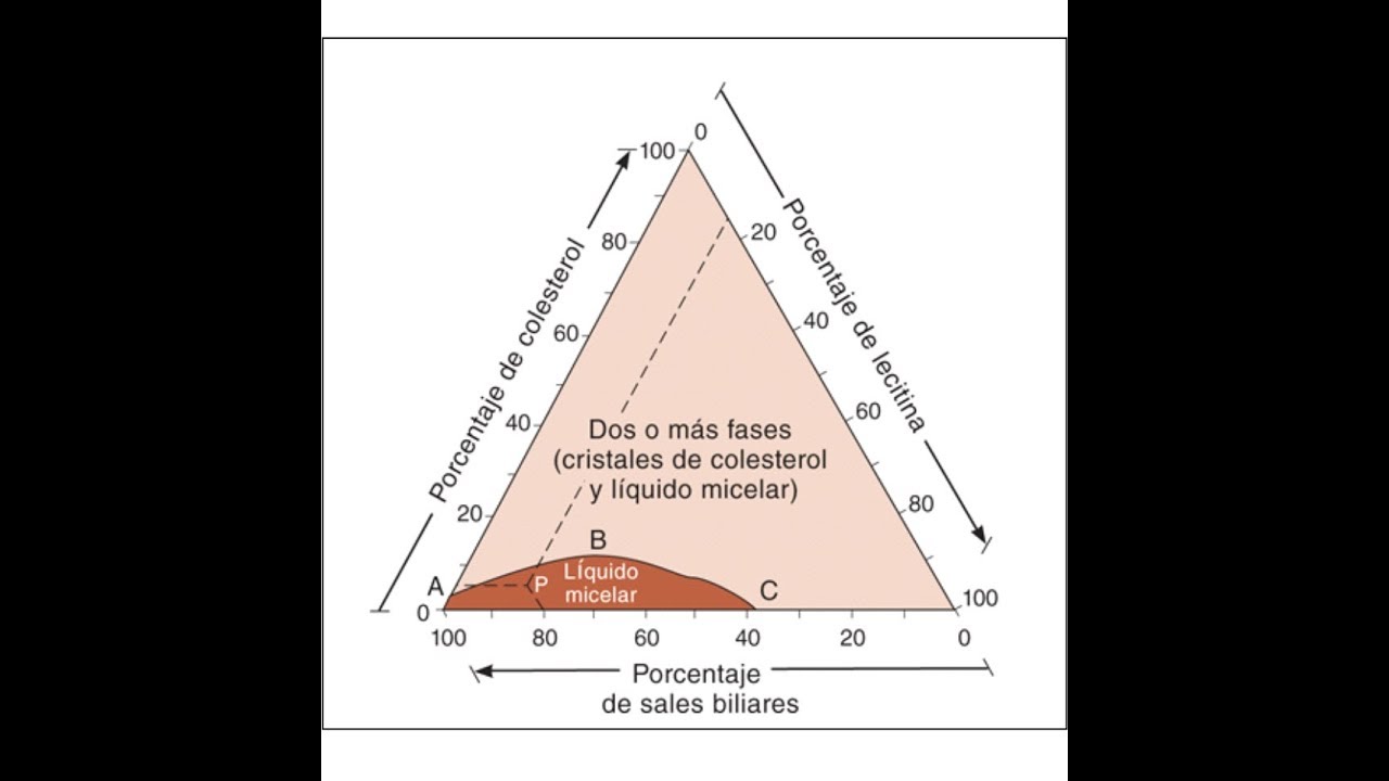 CIRUGÍA: La bilis litogenica en la litiasis vesicular se forma por ...
