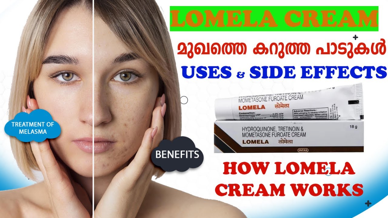 Lomela Cream | മുഖത്ത് കറുത്ത പാടുകൾ | പുള്ളികൾ #malayalam #benefits # ...