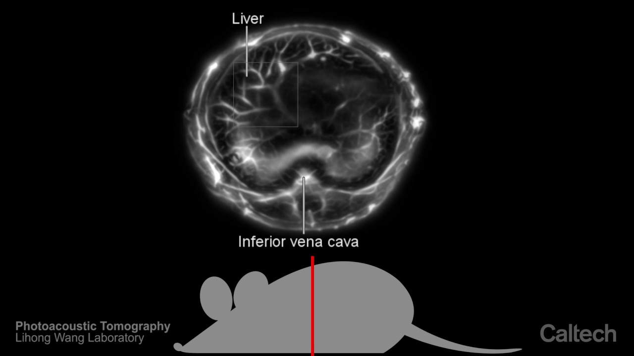 Photoacoustic Tomography - Lihong Wang Lab - YouTube