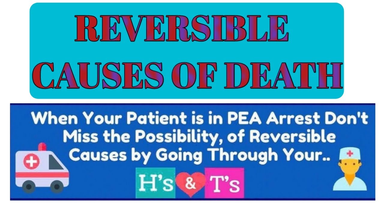 REVERSIBLE CAUSES OF DEATH , CARDIAC ARREST #NURSE_NOTE_2 - YouTube