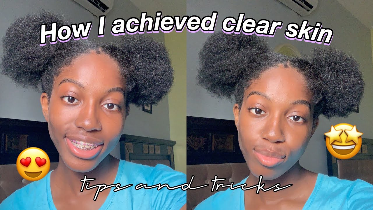 how i achieved clear skin in 2019 | CLEAR SKIN 101 | TalesOfBlossom ...