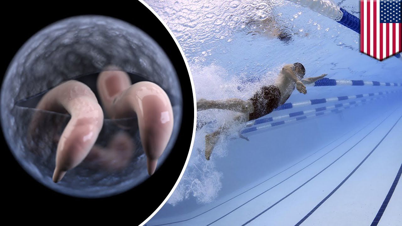 Diarrhea-causing Crypto parasite on the rise in U.S. pools, CDC warns ...
