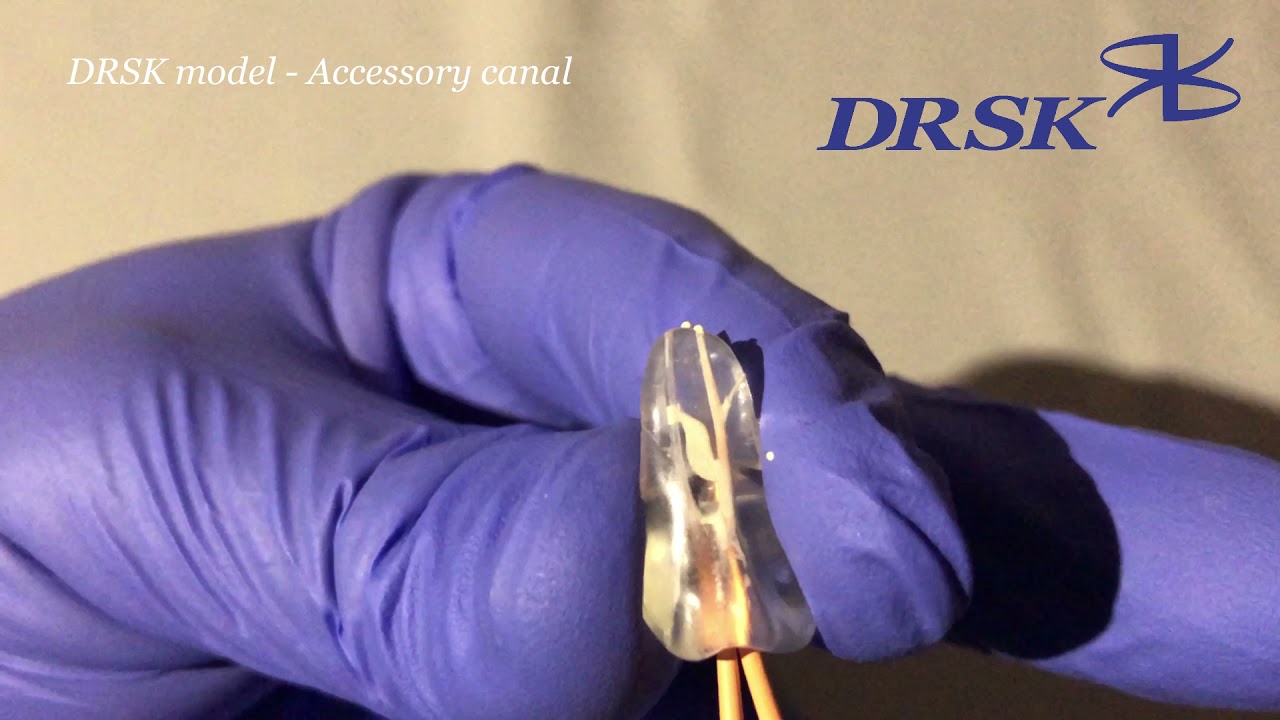 DRSK tooth model with accessory canals - YouTube