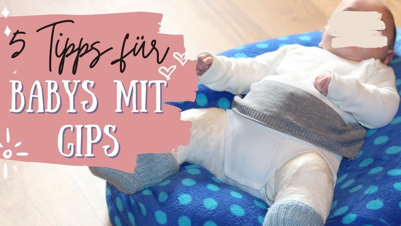 5 Tipps für Babys mit Gips - Hüftdysplasie - YouTube