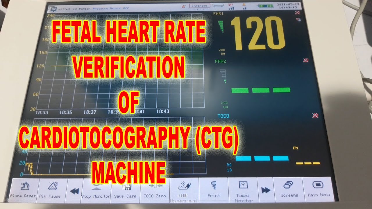 Fetal Heart Rate Verification of CTG Machine: A Glimpse of Biomedical ...