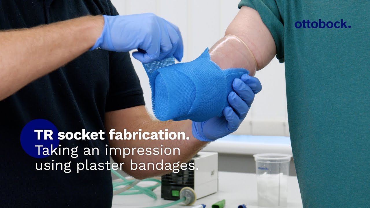 TR socket fabrication. Taking an impression using synthetic casting ...