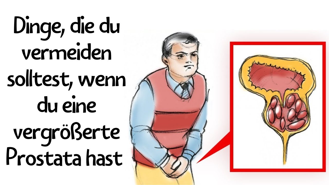 Diese Dinge solltest du vermeiden, wenn du eine vergrößerte Prostata ...
