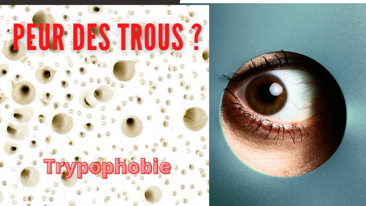 Trypophobie ou la peur des trous - YouTube