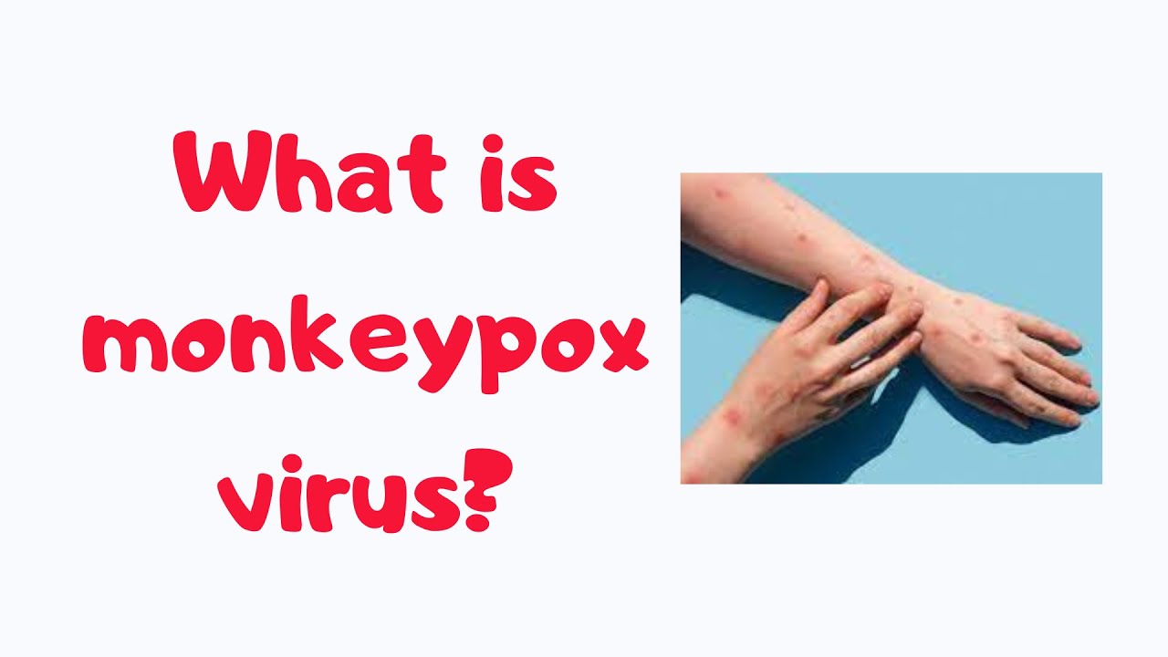 Monkeypox/Monkeypox Symptoms/Monkeypox Vaccine - YouTube